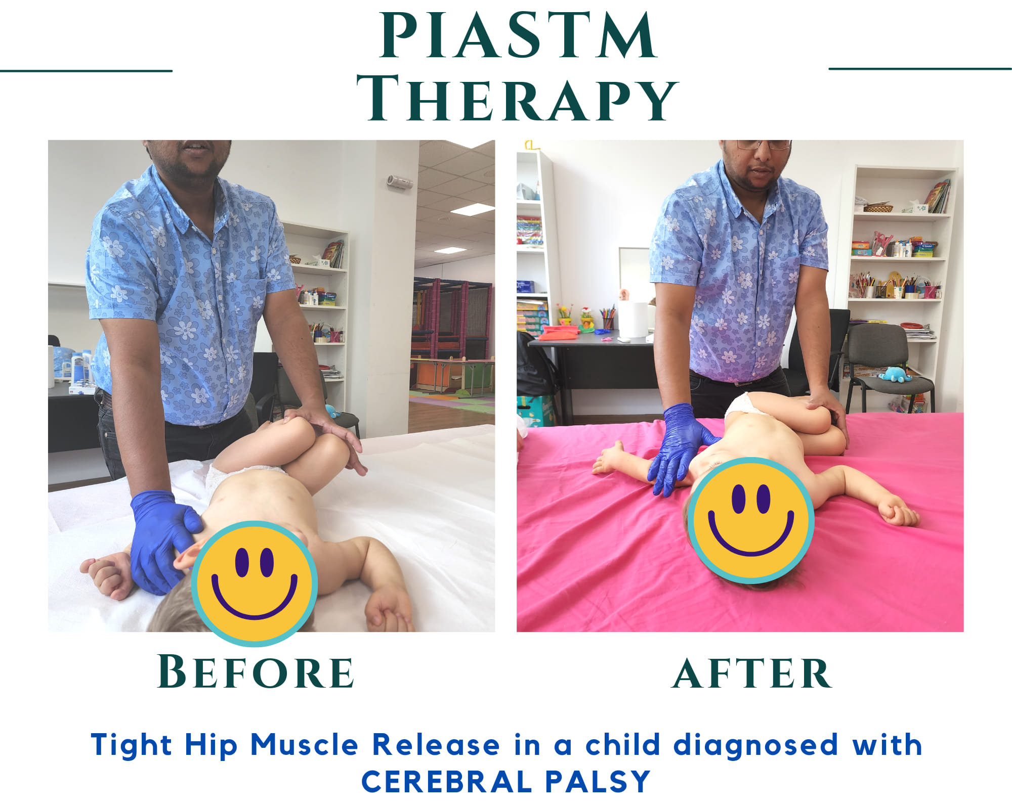 Results - PIASTM®