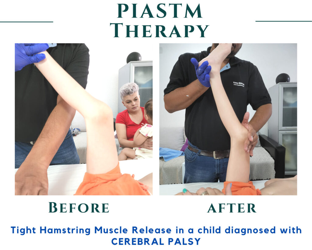 Results - PIASTM®