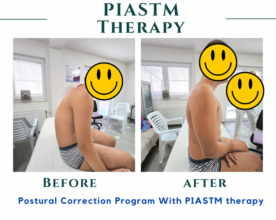 Results - PIASTM®