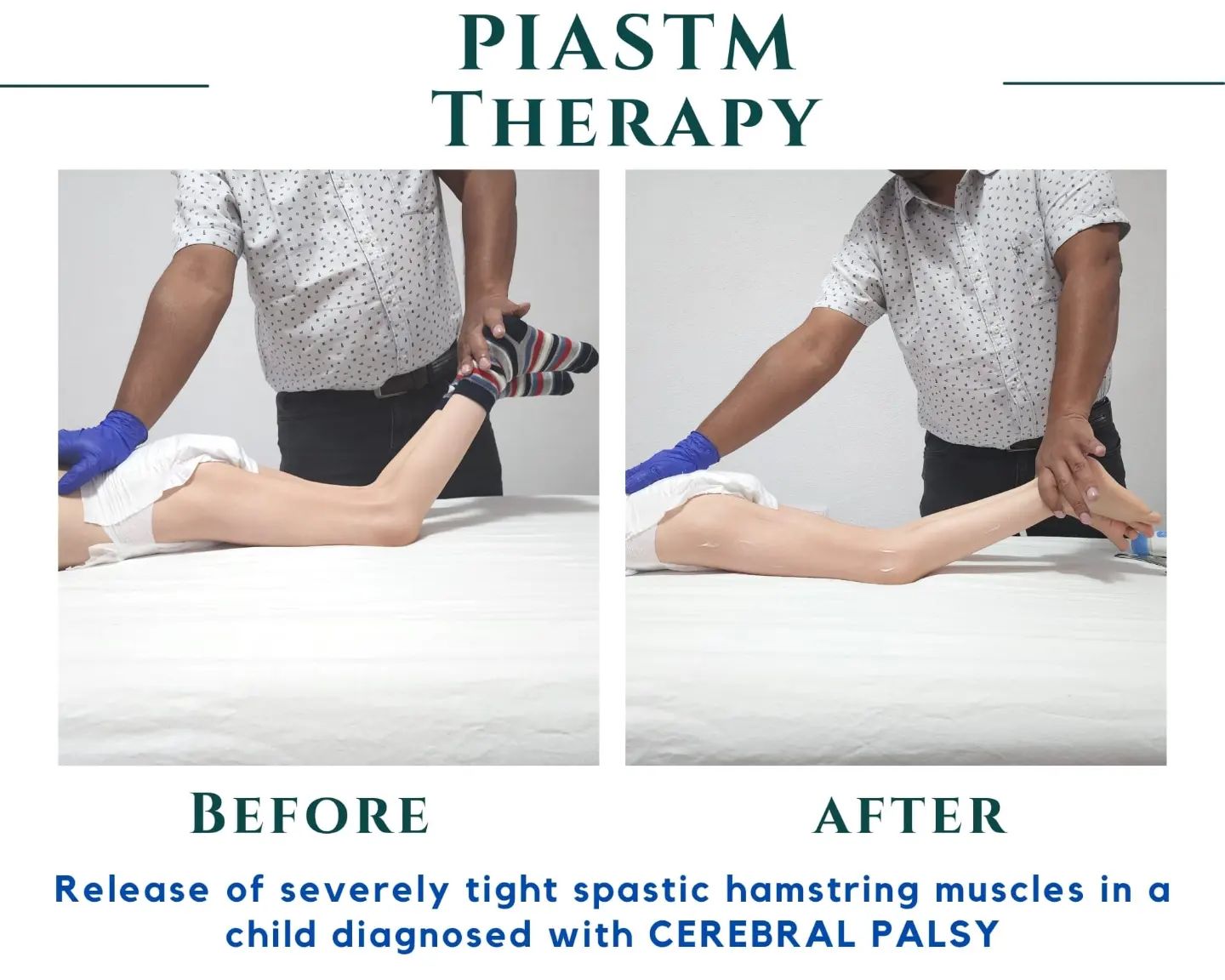 Results - PIASTM®