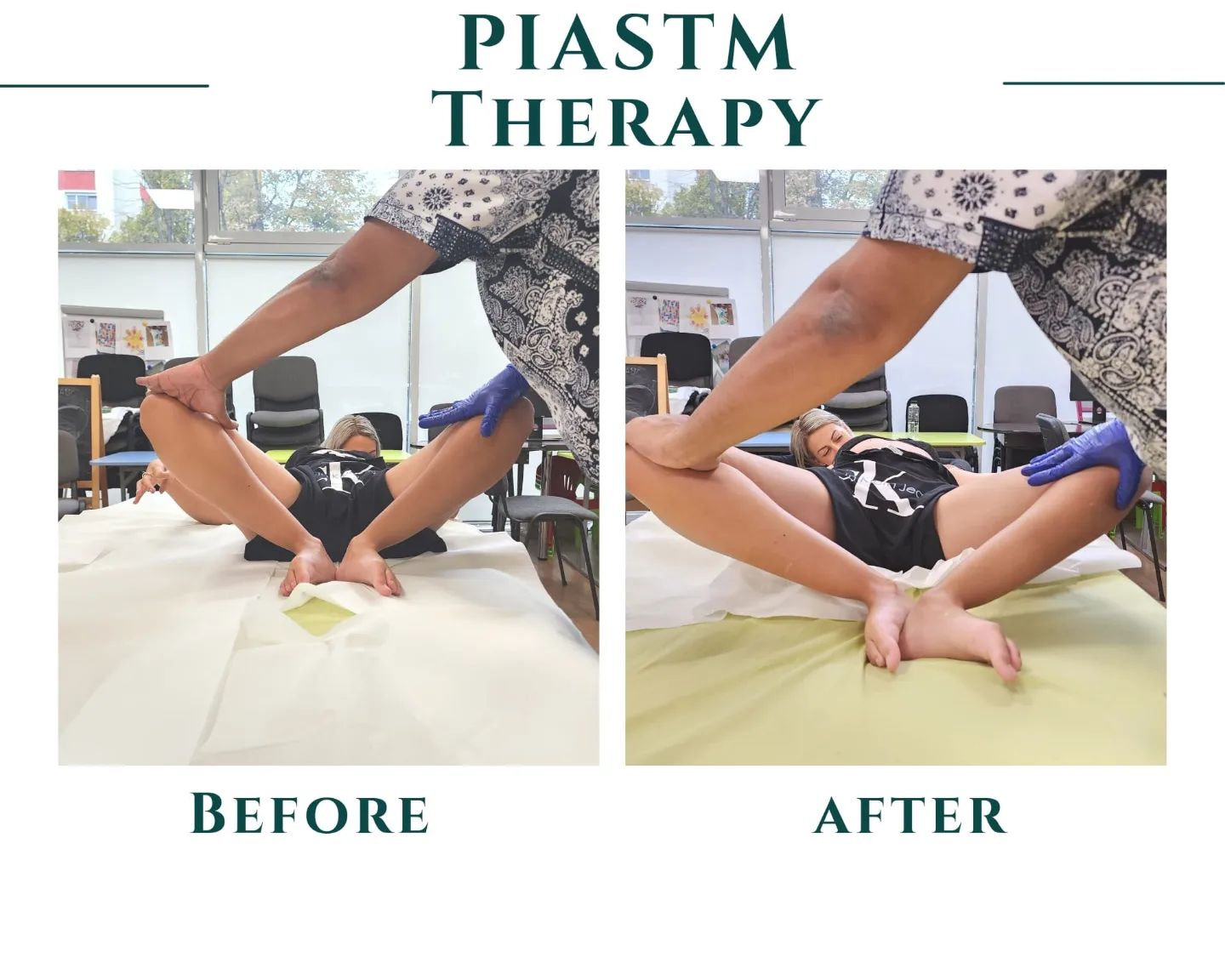 Results - PIASTM®